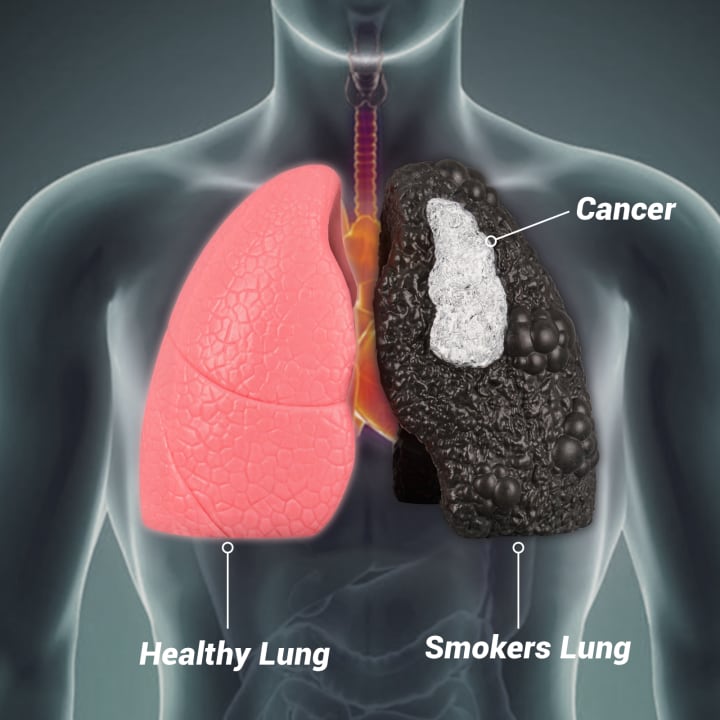 Smoking Lungs Recovery