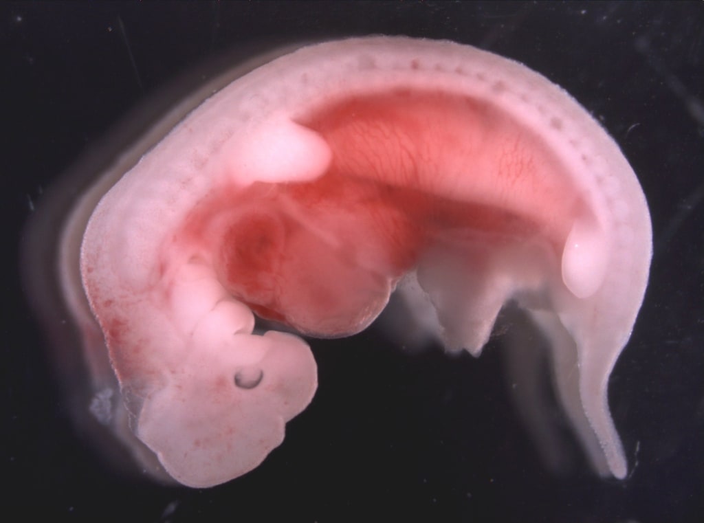 HUMAN EMBRYOLOGY Education HUMAN EMBRYOLOGY Education