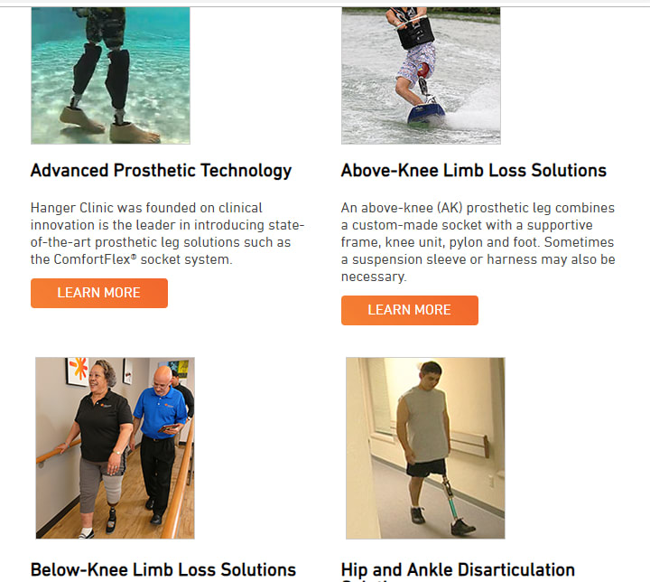 Prosthetic Leg Quotes