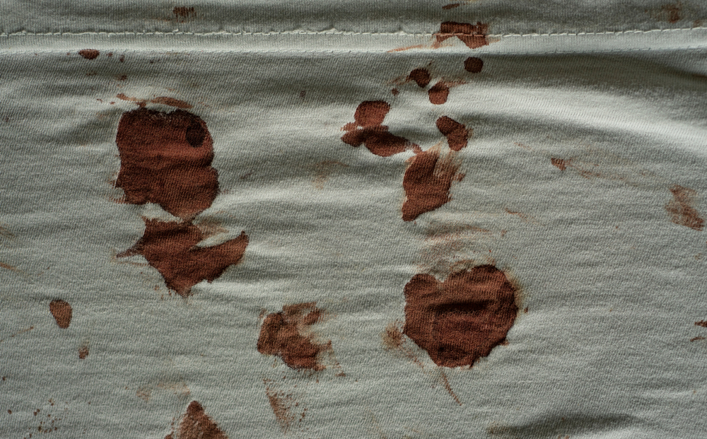 What Does Dried Blood Look Like On Clothes - Infoupdate.org