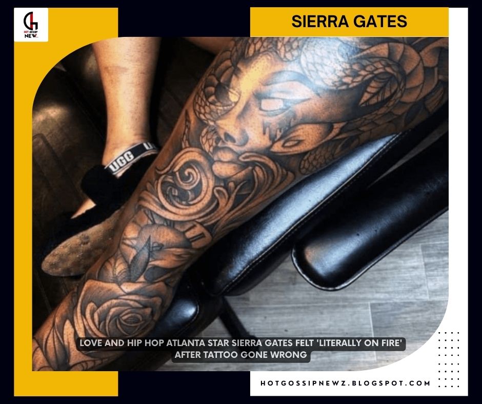 Cellulitis tattoo - Bronctattooaus.com