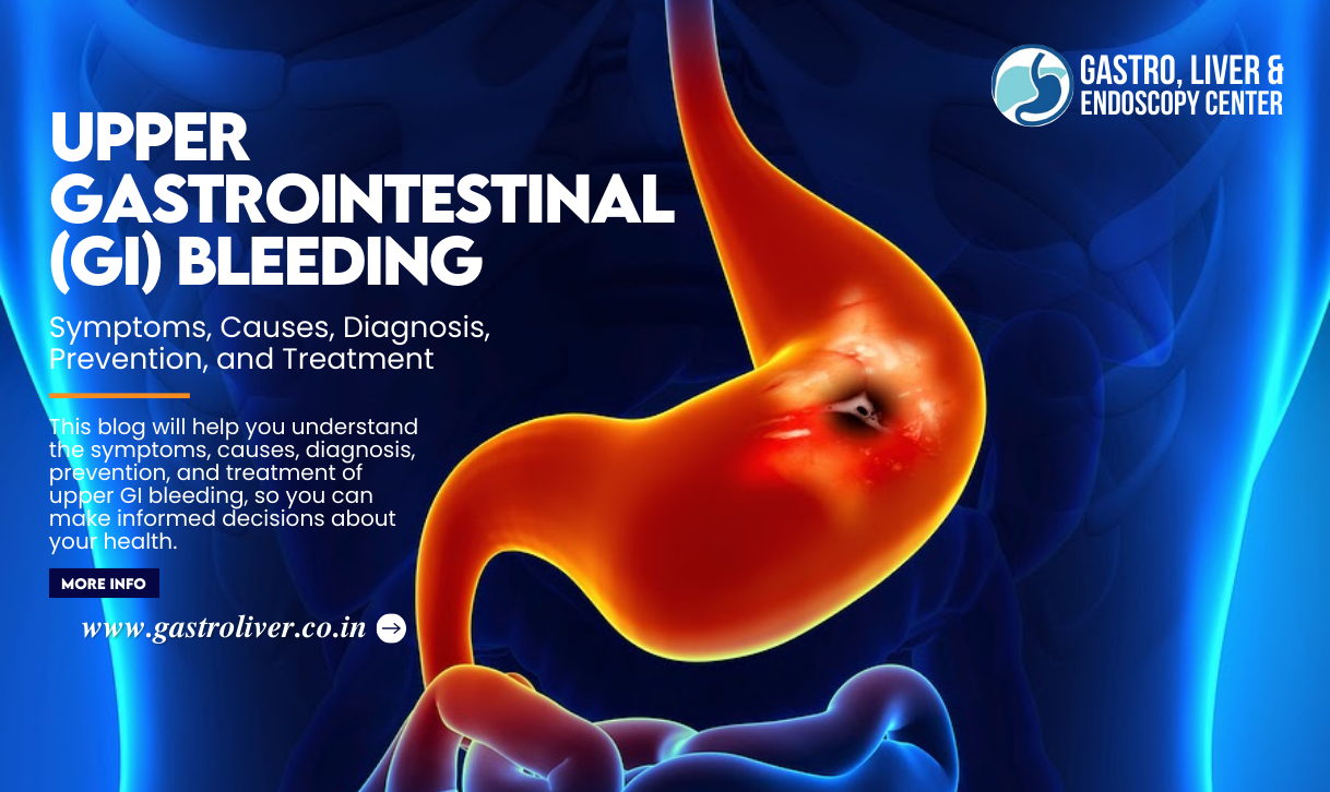 Upper Gi Bleed Symptoms ONE OF THE CAUSES OF LOWER GI BLEEDING IS