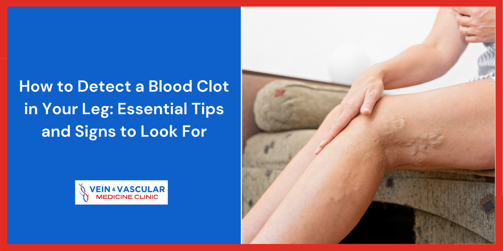 Early Signs Of Blood Clot Exploring Bioidentical Hormone Therapy: What