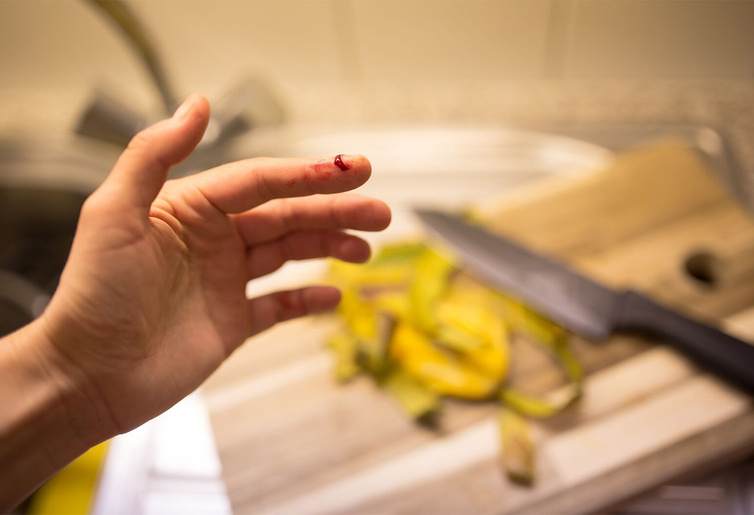 Why Do Kitchen Accidents Happen: Top Risk Factors Unveiled