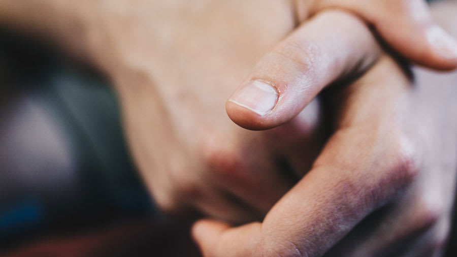 Nail Biting - Signs of Psychological Anxiety in Nails | LearnSkin
