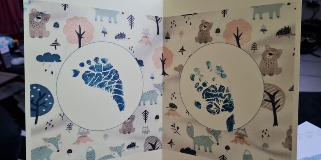 Cagnotte : Thibault | Leetchi