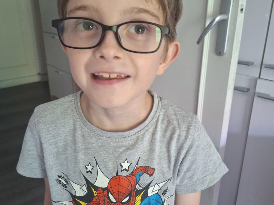 Cagnotte : Operation pour son œil gauche deficient suite à une ...