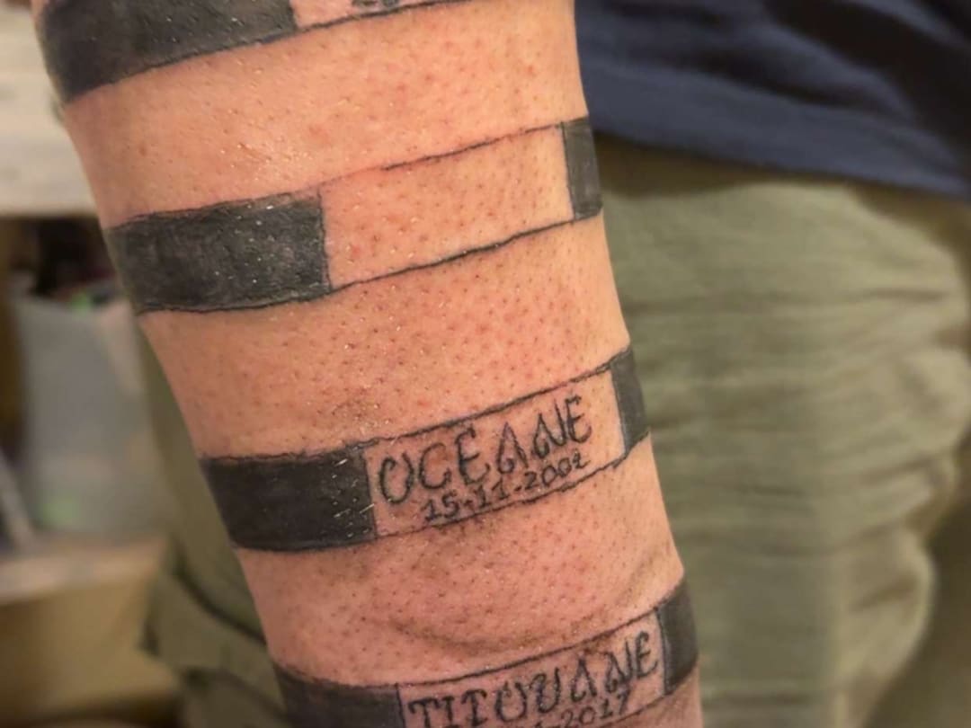 Cagnotte : pour sauver le bras de juss | Leetchi