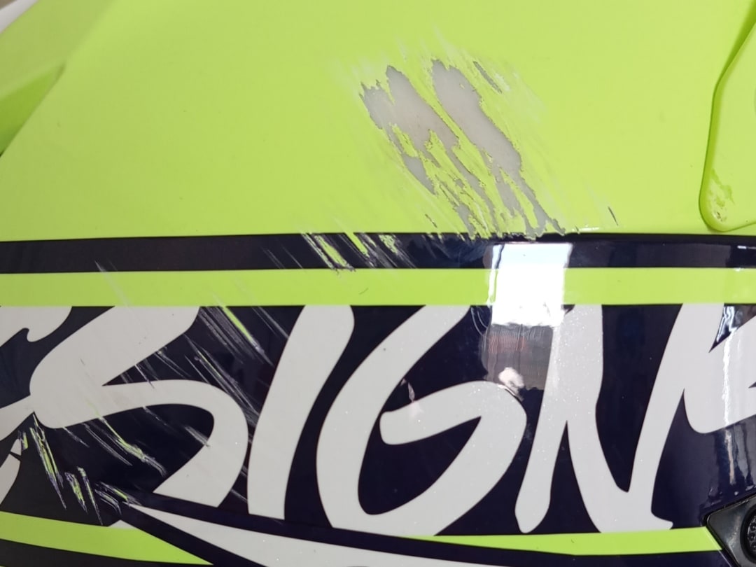 Cagnotte : Chute en bmx race | Leetchi