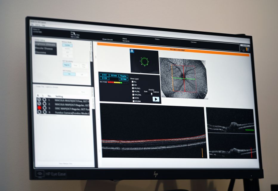 Optomap Eye Examination | Leightons