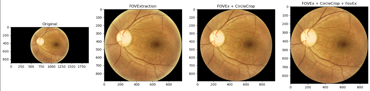 GitHub - serdna1/ODIR-5K-multi-label-classification