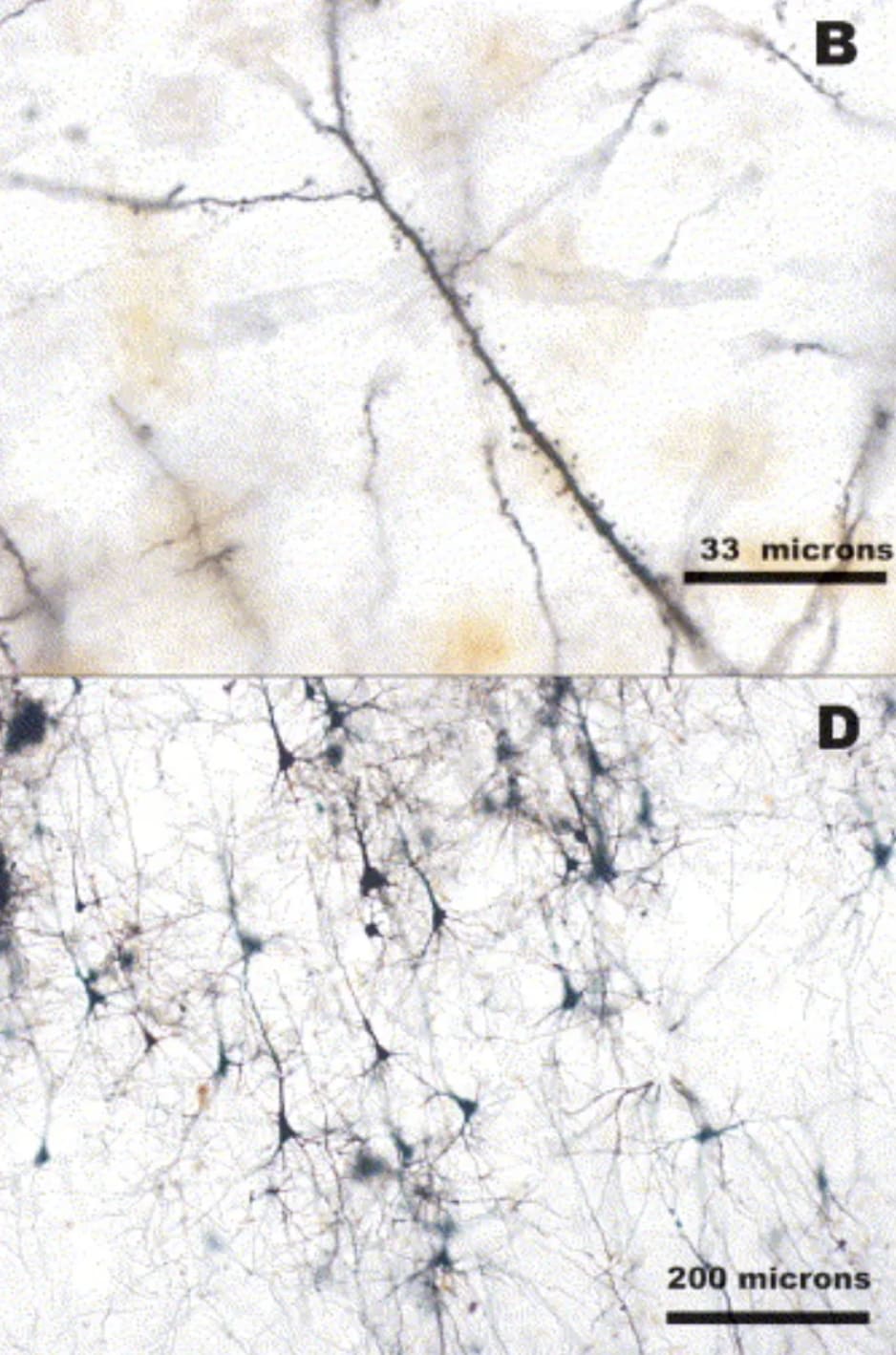 Refactoring cryonics as structural brain preservation — LessWrong