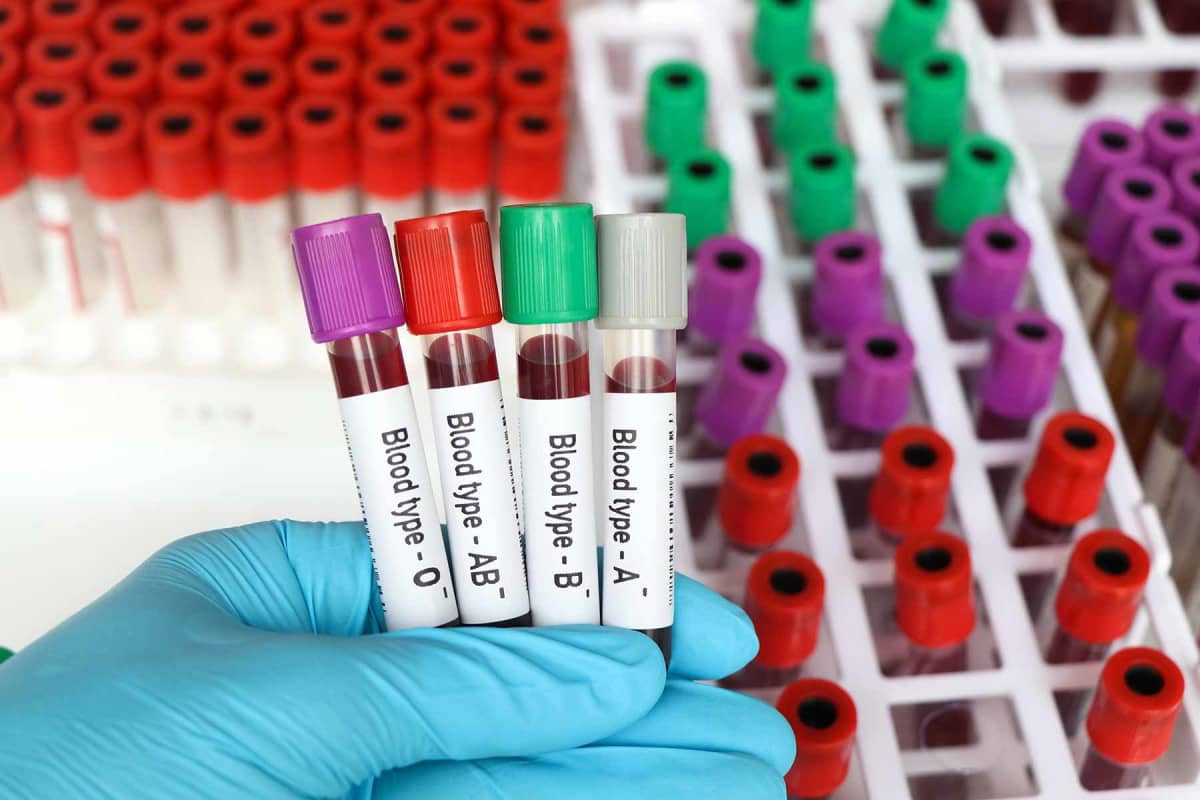 How Much Does a Blood Type Test Cost? (2026)