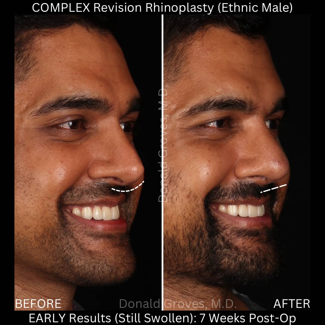 Linq - Donald Groves, M.D.