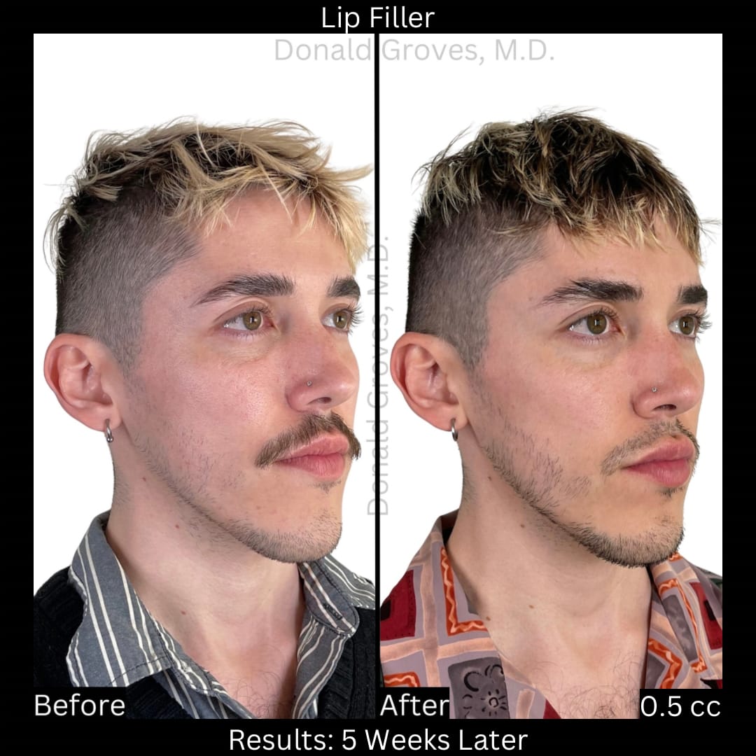 Linq - Donald Groves, M.D.