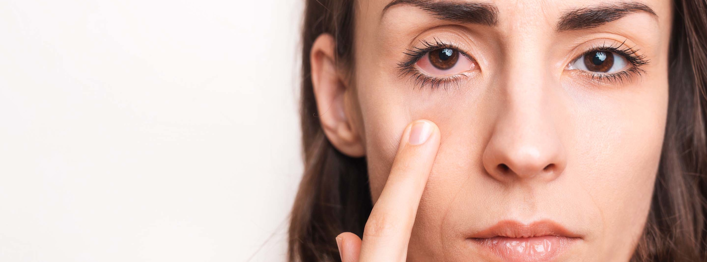 Rote Augen – Ursachen und Symptome – so schaffst du Abhilfe