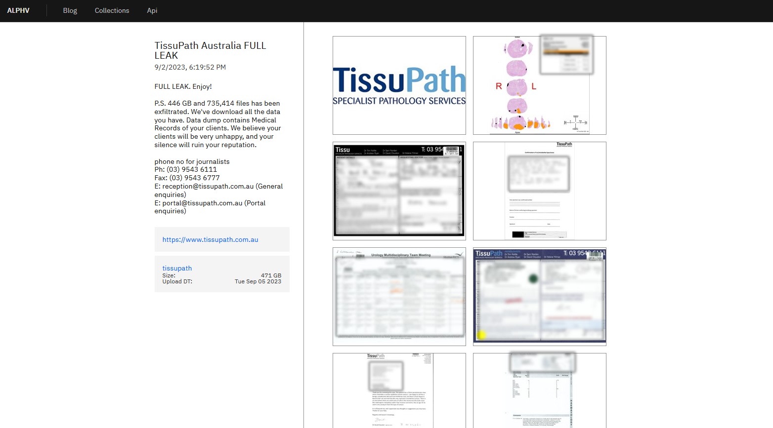 ALPHV’s TissuPath data breach is worse than you think, with over ...