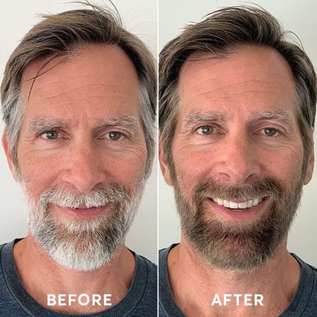 Light Brown Hair Color for Men & Beard Dye for Men | Madison Reed Mr.