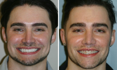 Chad Lite: The Ultimate Looksmaxxing Concept Explained (PSL Breakdown ...