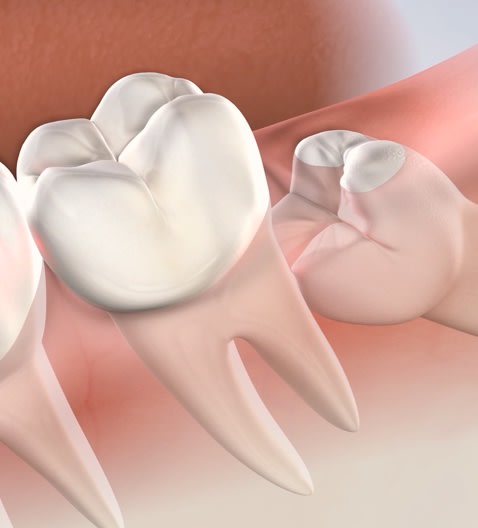 Procedures Archive - Oral Surgery Specialists of Oklahoma, Dental ...