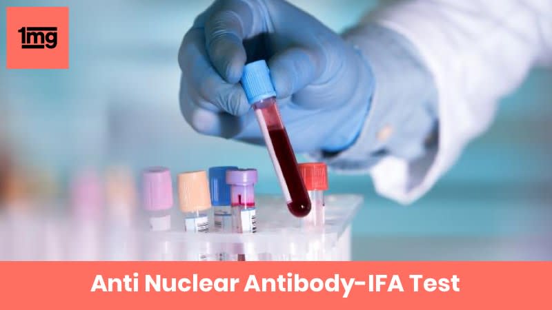 Anti Nuclear Antibody-IFA (ANA - IFA): Purpose & Normal Range of ...