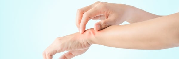 Understanding eczema and the available treatments