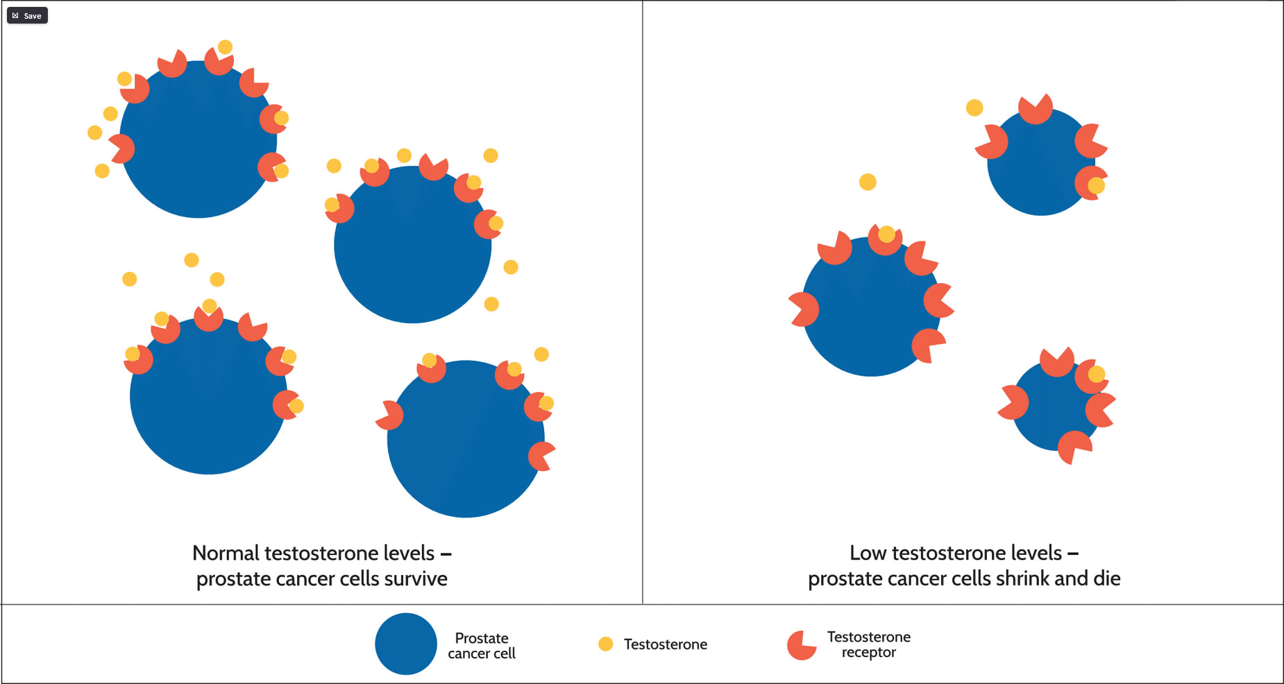 Hormone Therapy | Prostate Cancer Foundation
