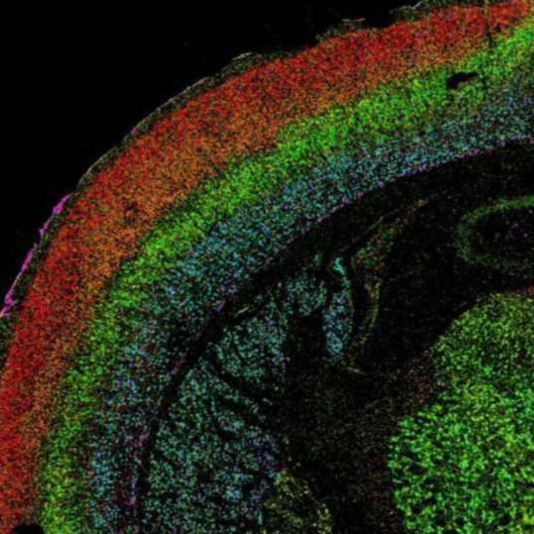 Resolving spatial biology in neuroscience - Talking Techniques | Acast