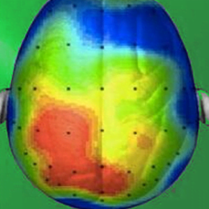 Learning | Postman API Network