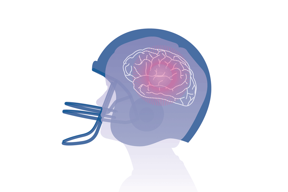 What You Should Do if Your Kid Gets a Concussion | Portland Monthly