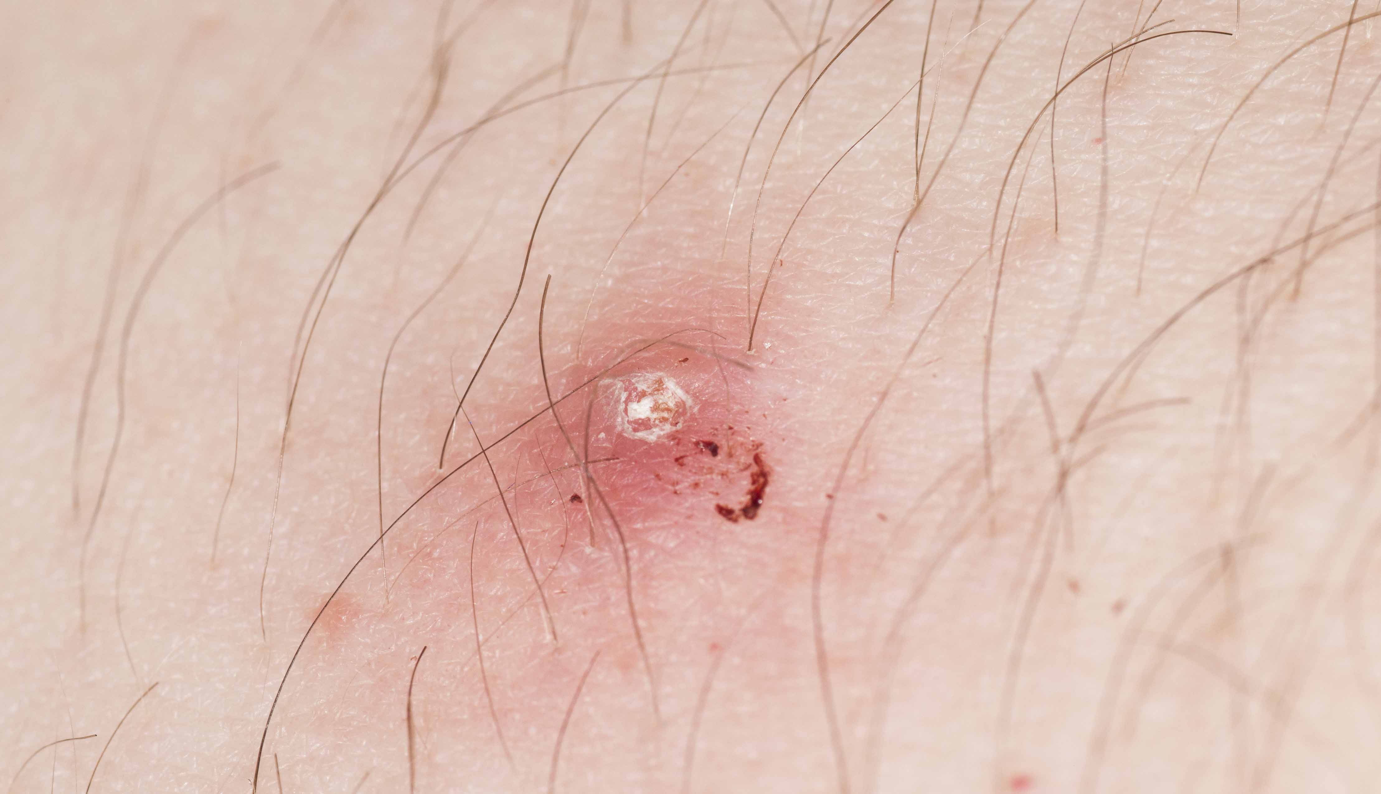 Våren er her - nå må du være obs på disse tre tingene