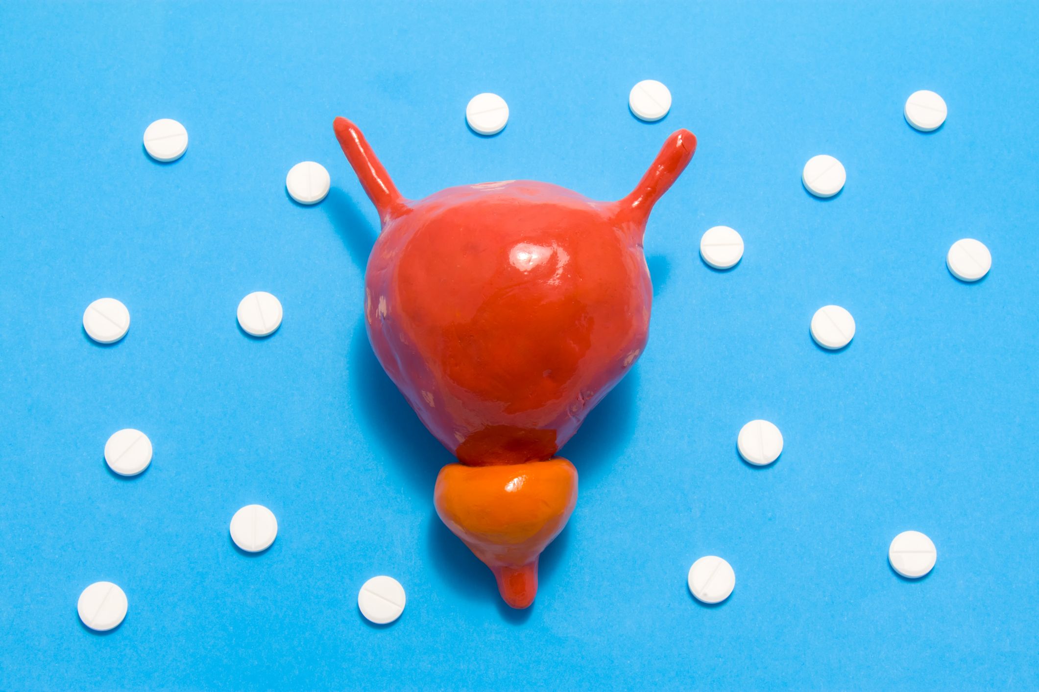 Treating Bladder Cancer: A Guide for Patients and Caregivers