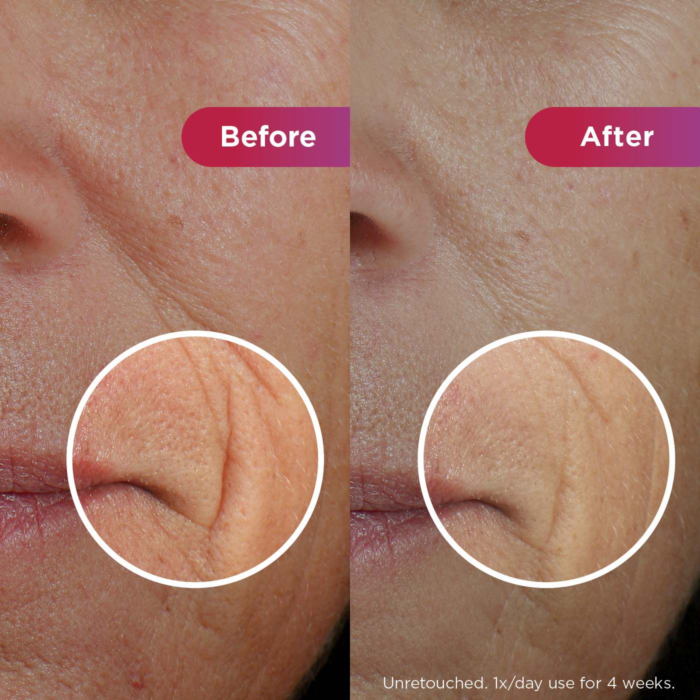 Shark LED Face Mask | Facial Light Therapy – Shark Beauty UK