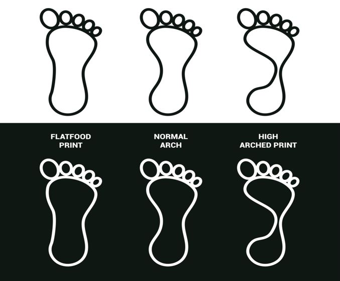Supination Footprint