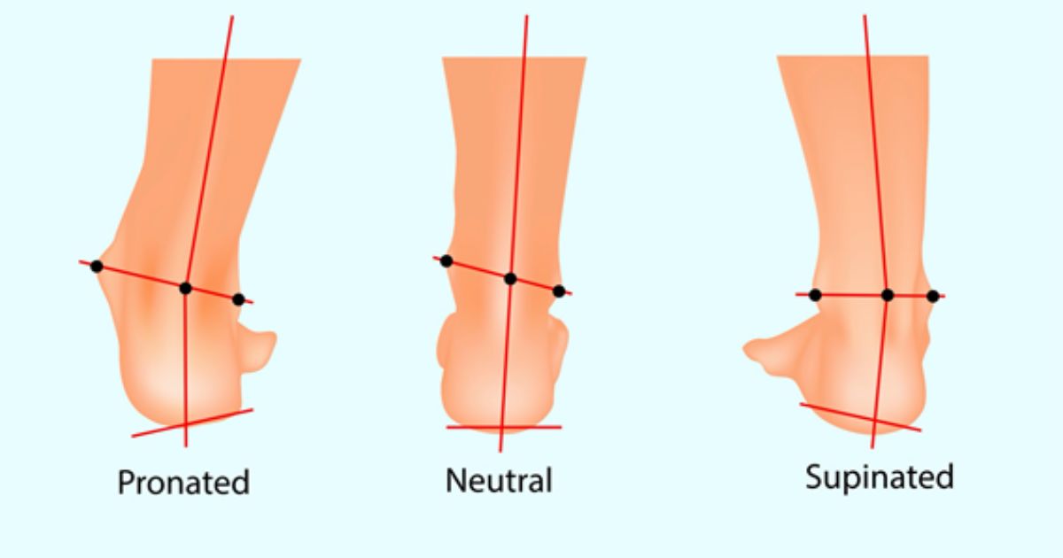 Pronation and Supination: 3 Foot-Friendly Tips for Runners | by Lucie ...