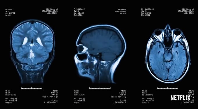 A brainwave symphony - stoppress.co.nz