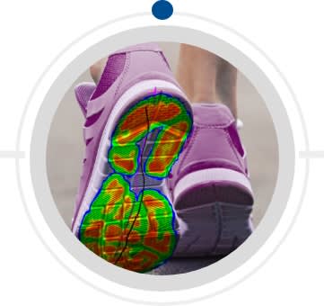 Foot Scan & Phits 3D Printed Orthotics | South Down Foot Clinic