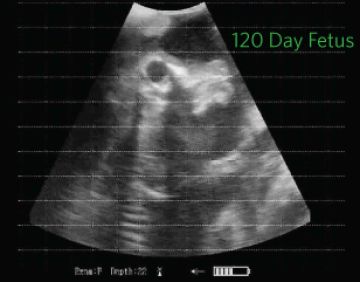 Tips, Tricks and Techniques – Fetal Aging: Plan Ahead for Success ...