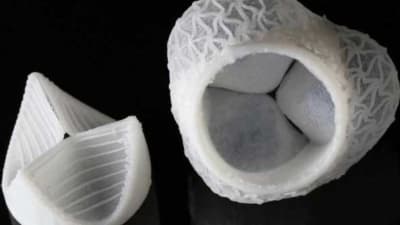 Custom, 3D-Printed Silicone Heart Valves Fit Patients Perfectly - Tech ...