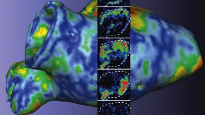 3D-Printed Working Heart Pump with Real Human Cells - Tech Briefs