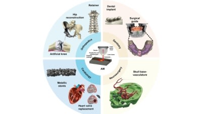 Additive Manufacturing of Biomedical Metals for Medical Implant ...