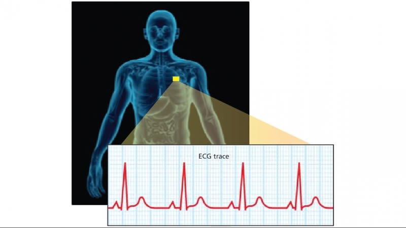 Signal Processing Software for Remote Vital Sign Monitoring - Tech Briefs