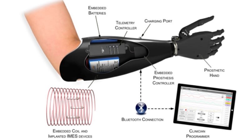 2018 Medical Winner: An Implantable Sensor Technology Platform for ...