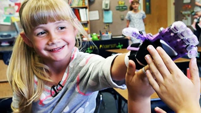 3D-Printed Prostheses — Accessible and Affordable - Tech Briefs 3D-Printed Prostheses — Accessible and Affordable - Tech Briefs