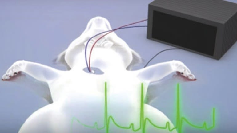 Optical Defibrillation: Light Tames Lethal Heart Disorders in Lab Tests ...