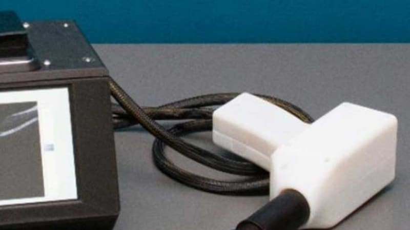 Handheld 3D Imaging Scanner Helps Doctors Diagnose Chronic Conditions ...