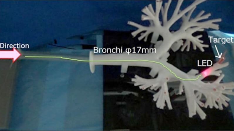 Navigating Inside Airways Using 'GPS' Technology - Tech Briefs