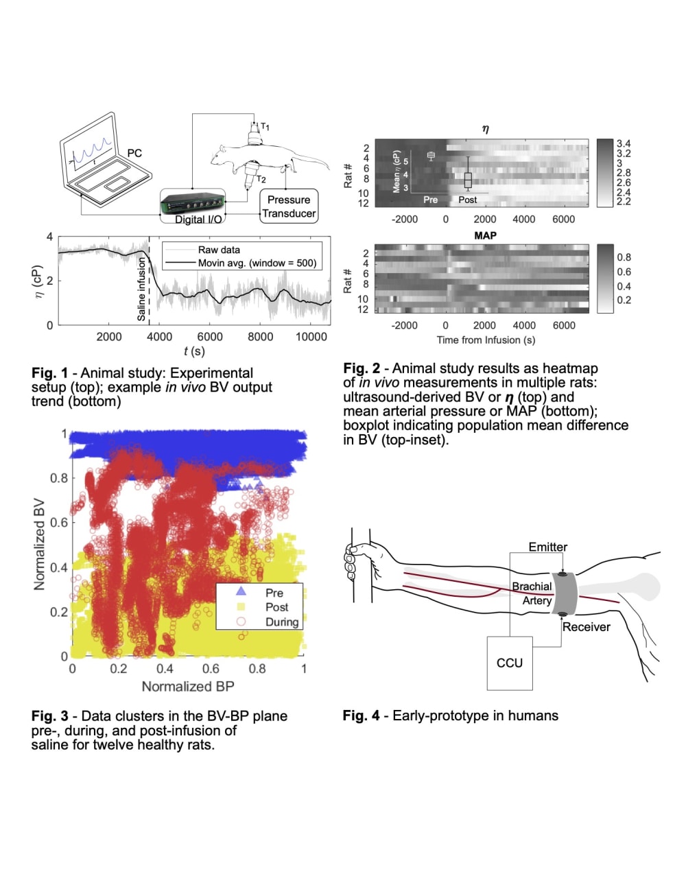 Blood Viscosity: The Next Vital Sign – A Wearable Breakthrough in ...