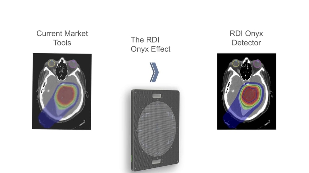 RDI Onyx - Better Imaging, Better Results - Create the Future