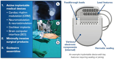 medical implants examples